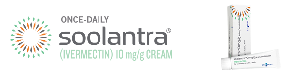 SOOLANTRA receptbelagt läkemedel mot rosacea – information avsedd för ...